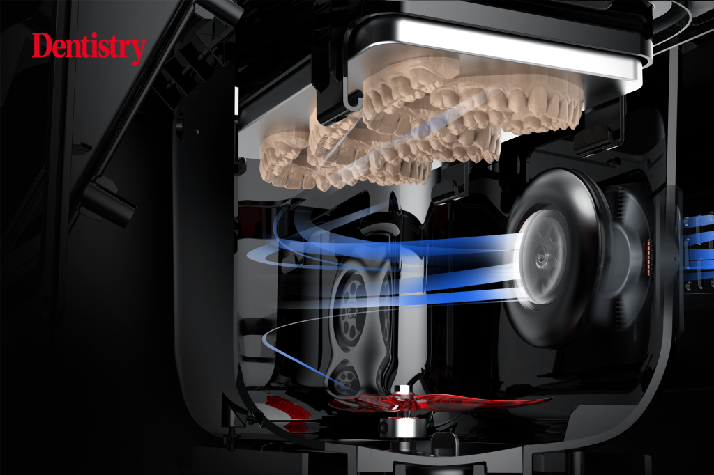 The next generation of dental 3D printing post-processing - Dentistry