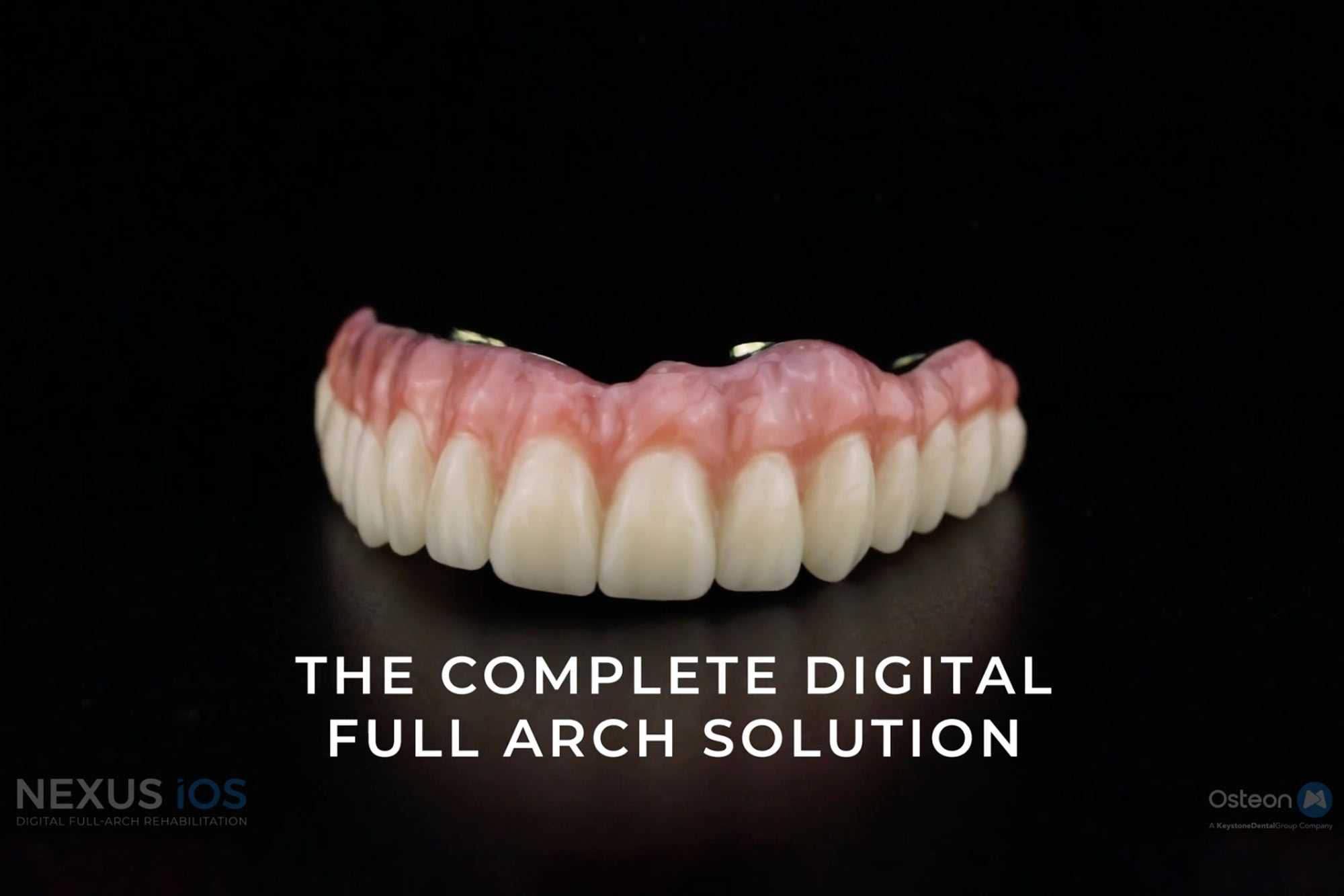 Nexus Ios A Fully Digital Full Arch Solution Dentistry