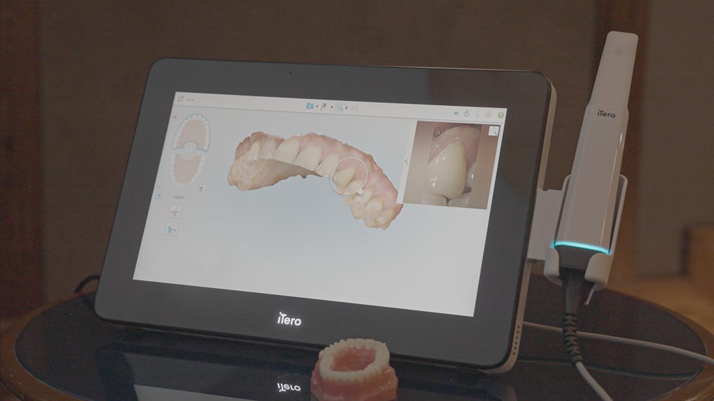 Lighting the way: Align launches Itero Lumina scanner - Dentistry