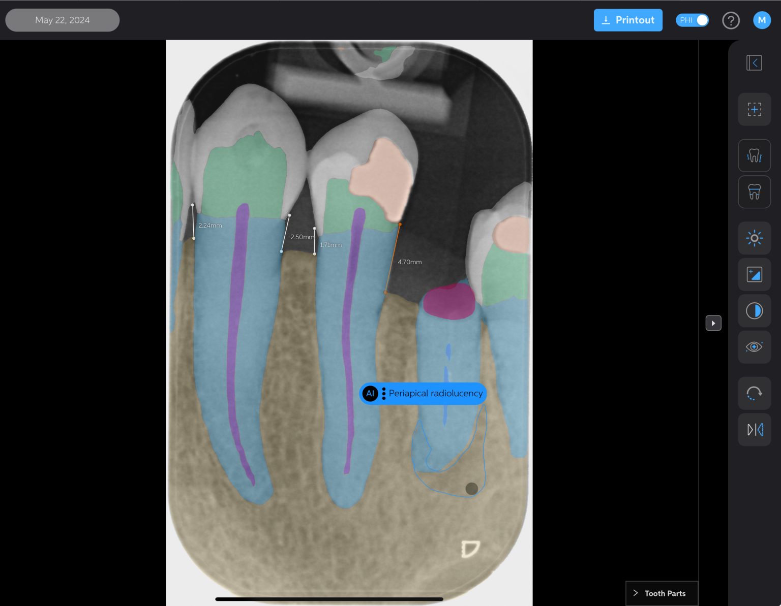 Artificial intelligence is not replacing dentists – it is here to help ...