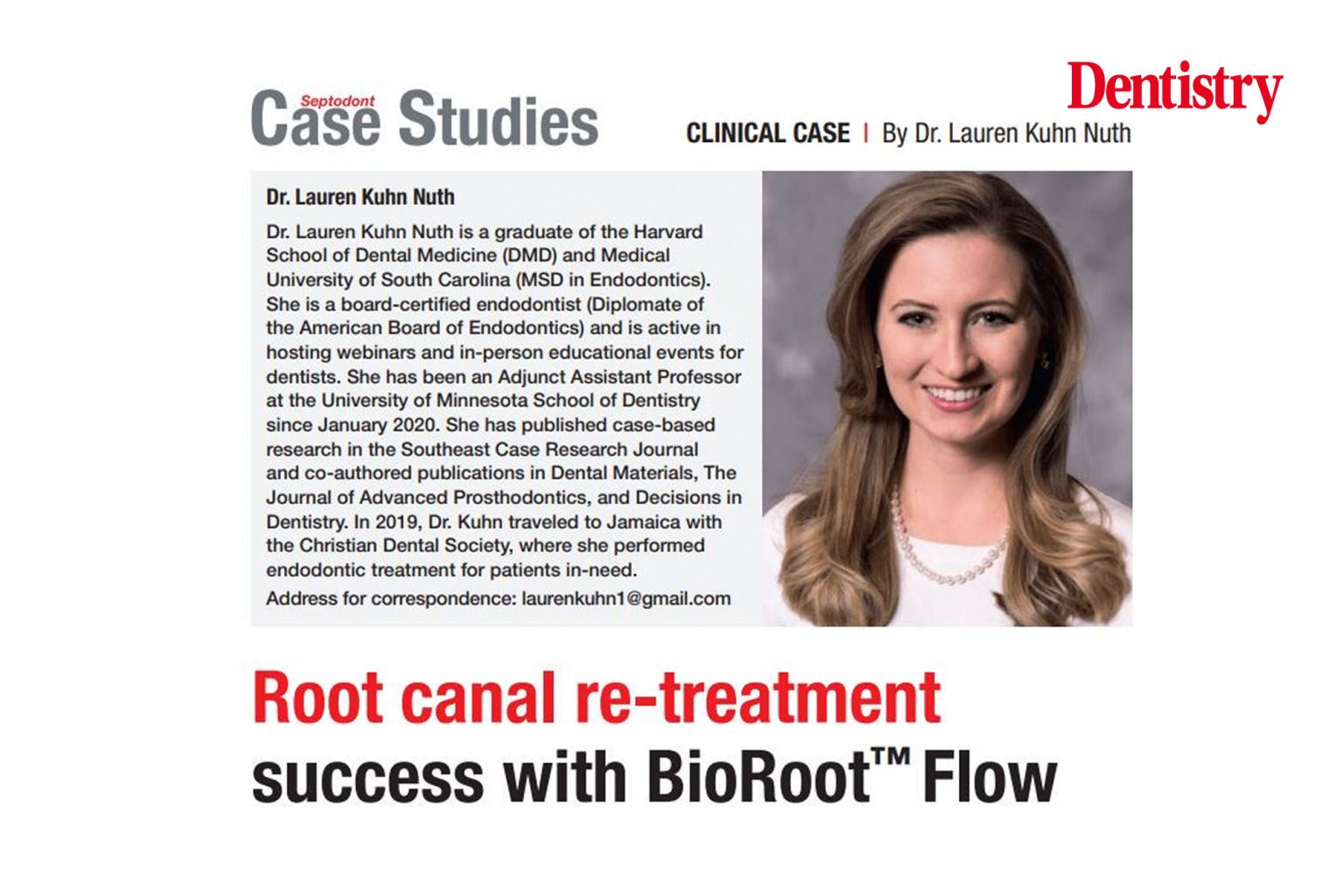 Successful root canal re-treatment with BioRoot Flow - Dentistry
