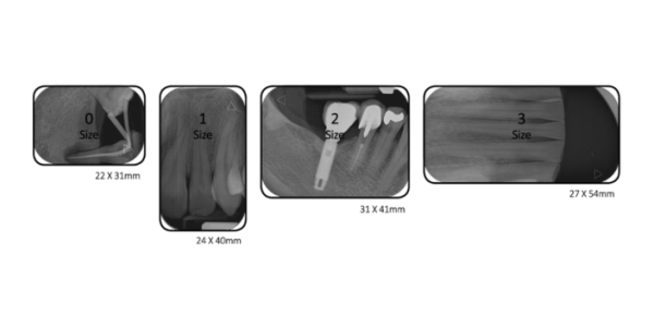 Dentistry’s guide to digital dental X-rays - Dentistry.co.uk