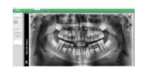 Dentistry’s guide to digital dental X-rays - Dentistry.co.uk