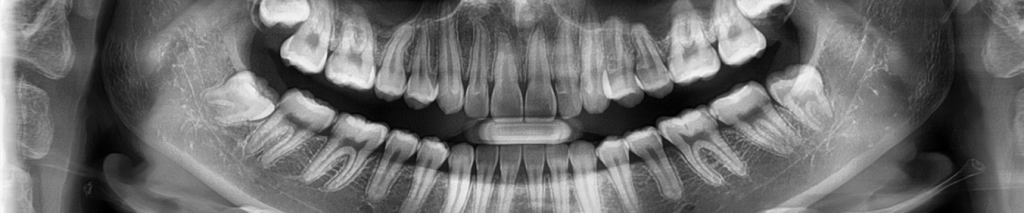 Dentistry’s guide to digital dental X-rays - Dentistry.co.uk