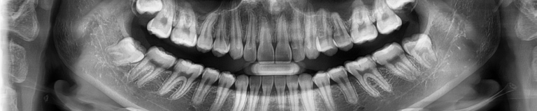 Dentistry’s guide to digital dental X-rays - Dentistry.co.uk
