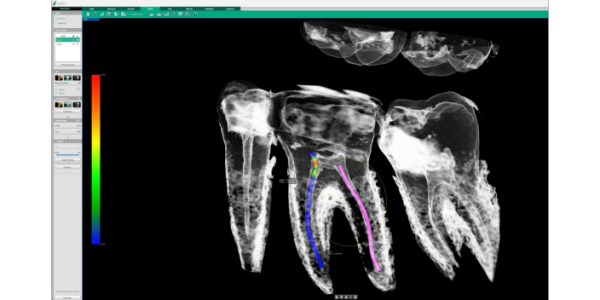 Dentistry’s guide to digital dental X-rays - Dentistry.co.uk