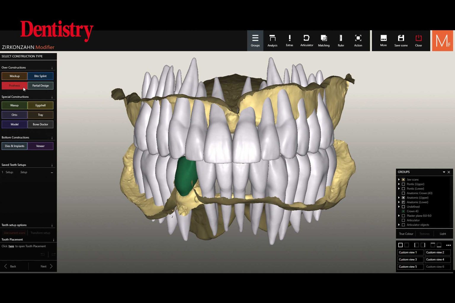 High-tech meets handicraft: Zirkonzahn lecture tour 2025 - Dentistry