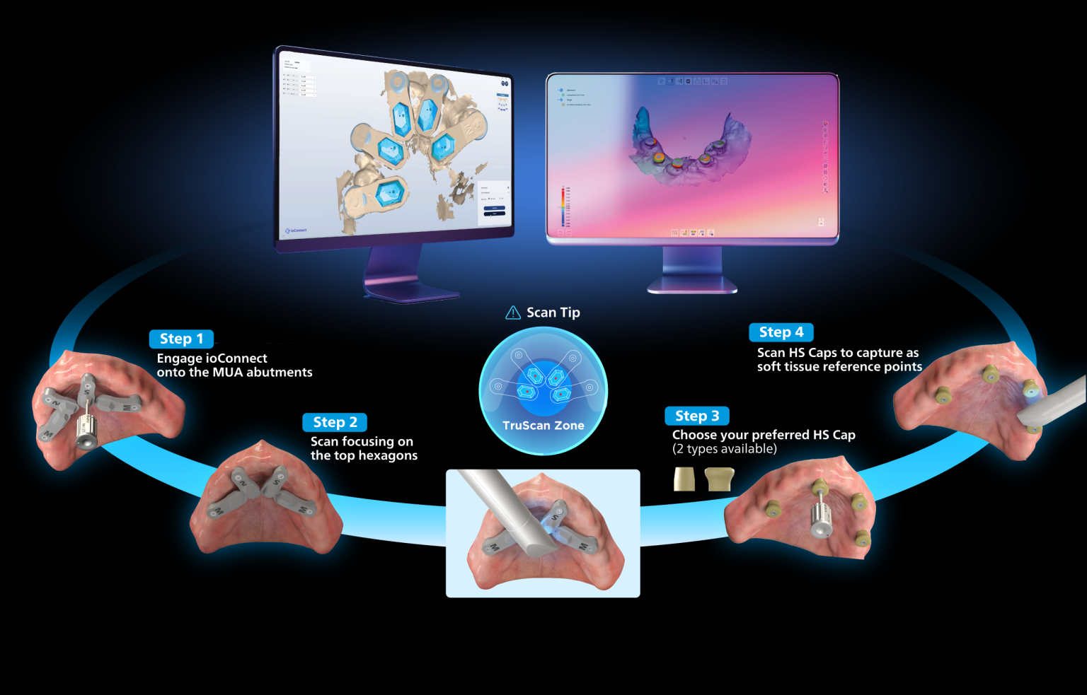 Huge leap forward in digital innovation for dental labs - Dentistry