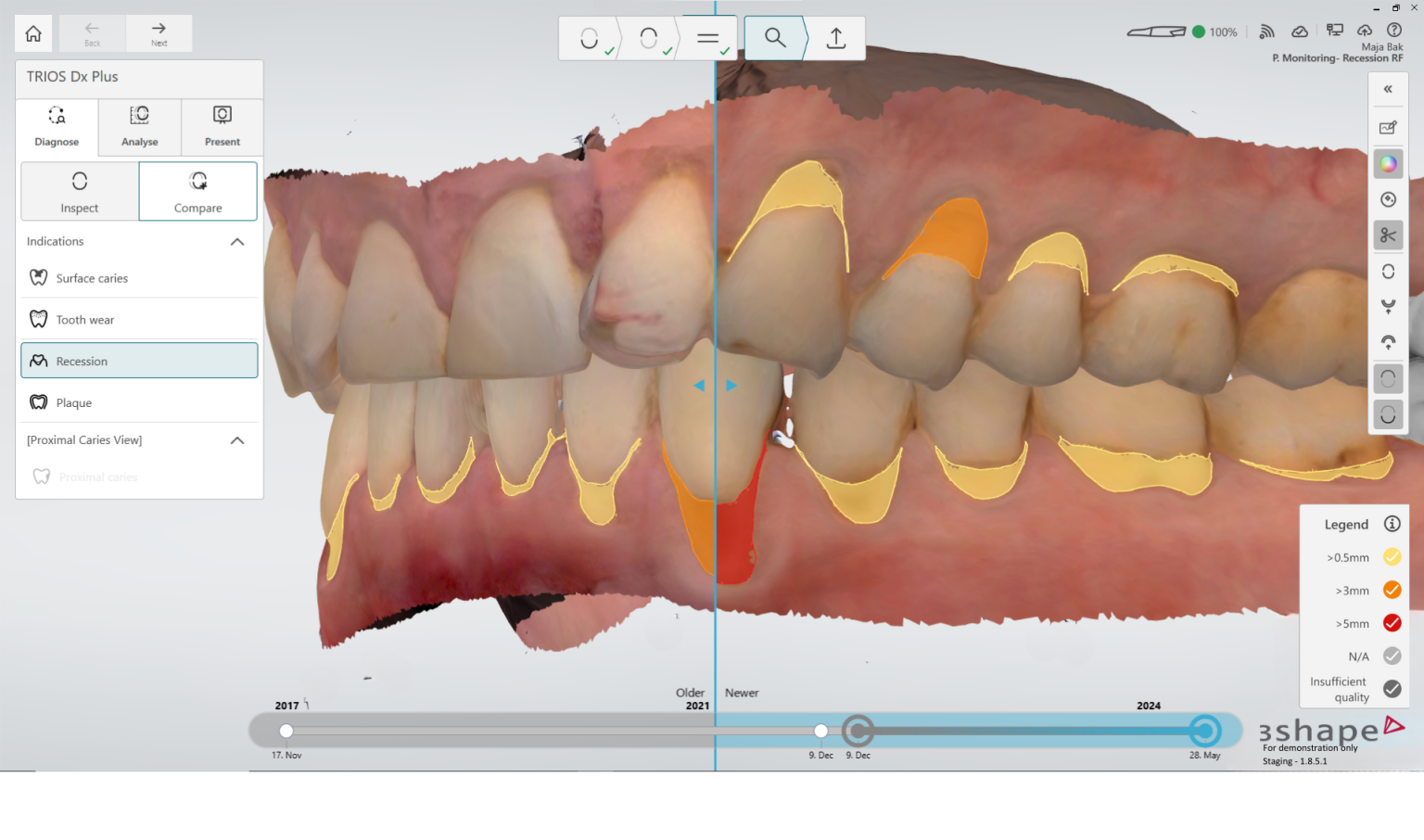 3Shape unveils revolutionary TRIOS 6 Intraoral Scanner - Dentistry