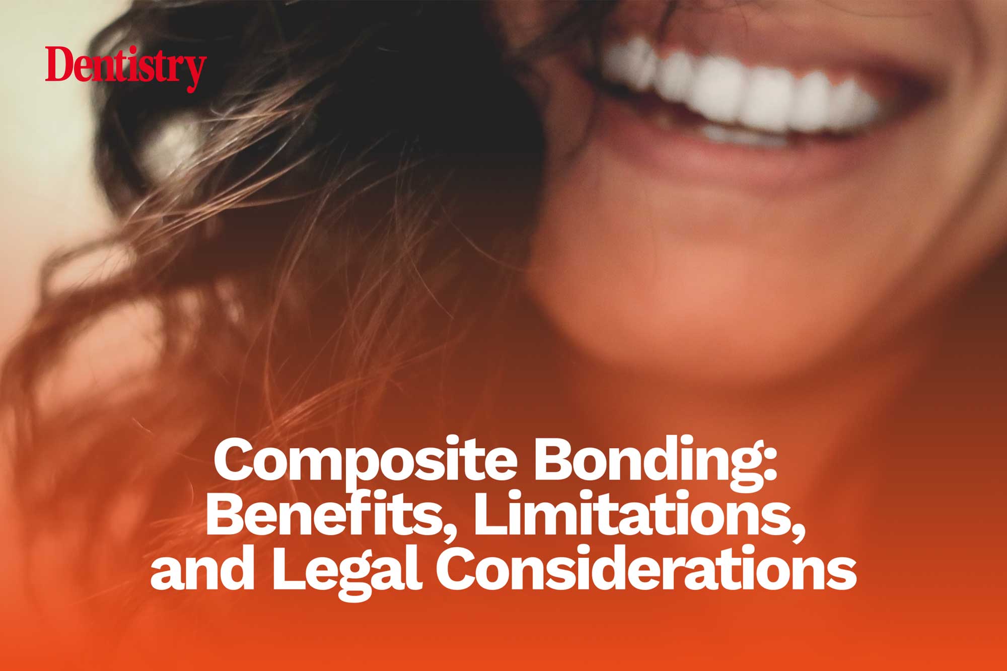 Composite bonding: communicating the pros and cons - Dentistry