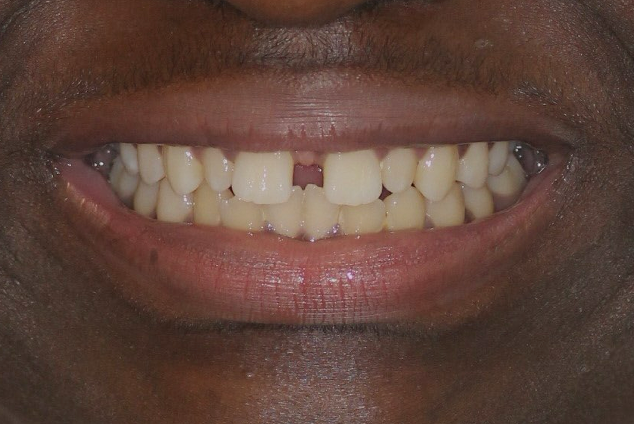 ADA-0259 Sept Generic FMC Article Graphics-08 - Dentistry.co.uk