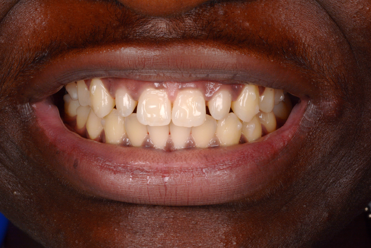 ADA-0259 Sept Generic FMC Article Graphics-09 - Dentistry.co.uk