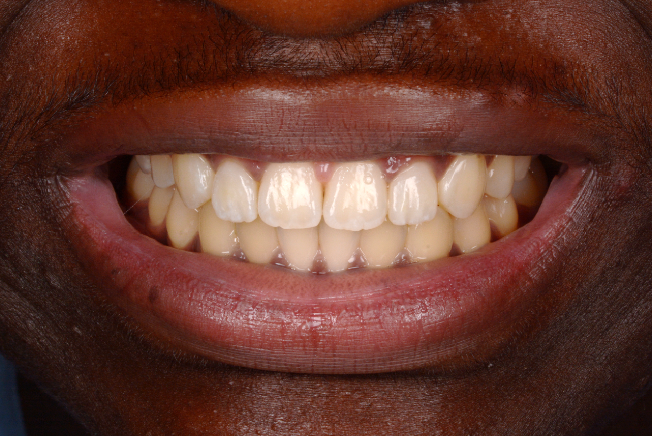 ADA-0259 Sept Generic FMC Article Graphics-10 - Dentistry.co.uk