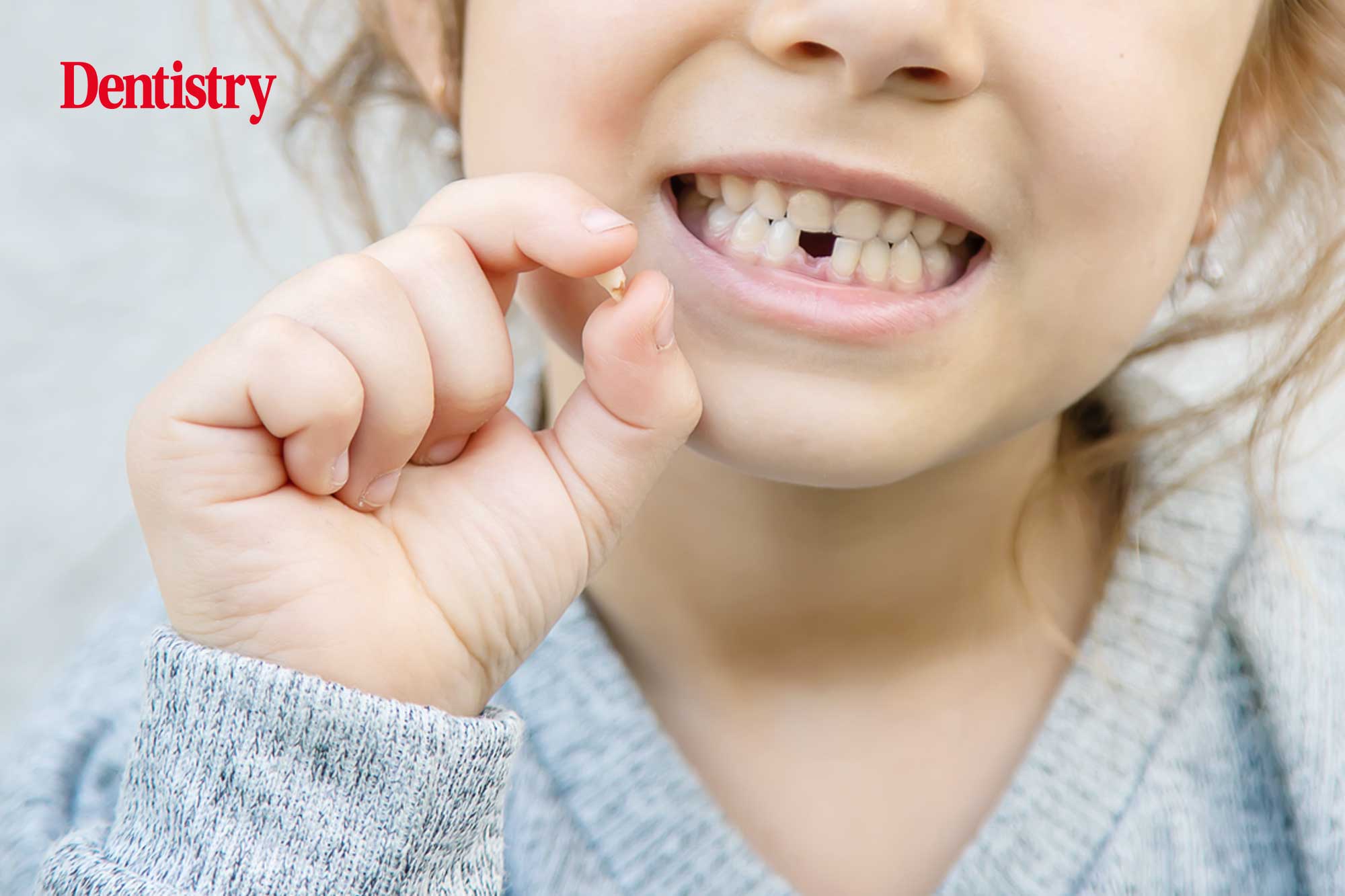 Parents banking milk teeth based on 'outrageous' claims - Dentistry