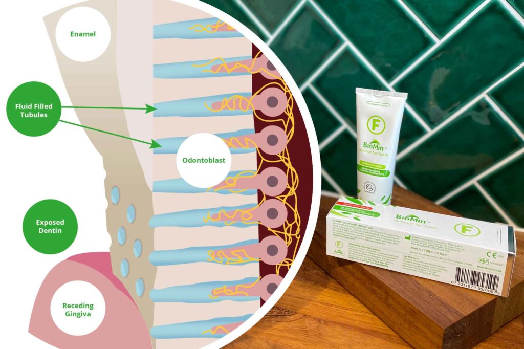 Biomin F: more a therapy than a just toothpaste – Dentistry Online